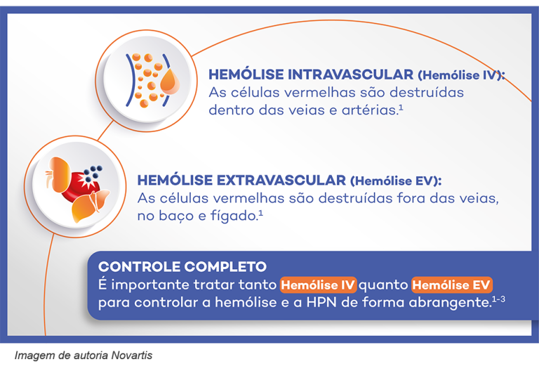Como a Hemólise e a HPN Afetam sua Qualidade de Vida - HPN - Hemoglobinúria Paroxística Noturna